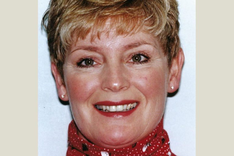 Before & Afters | Veneman Dental Care | Wisconsin | Minnesota